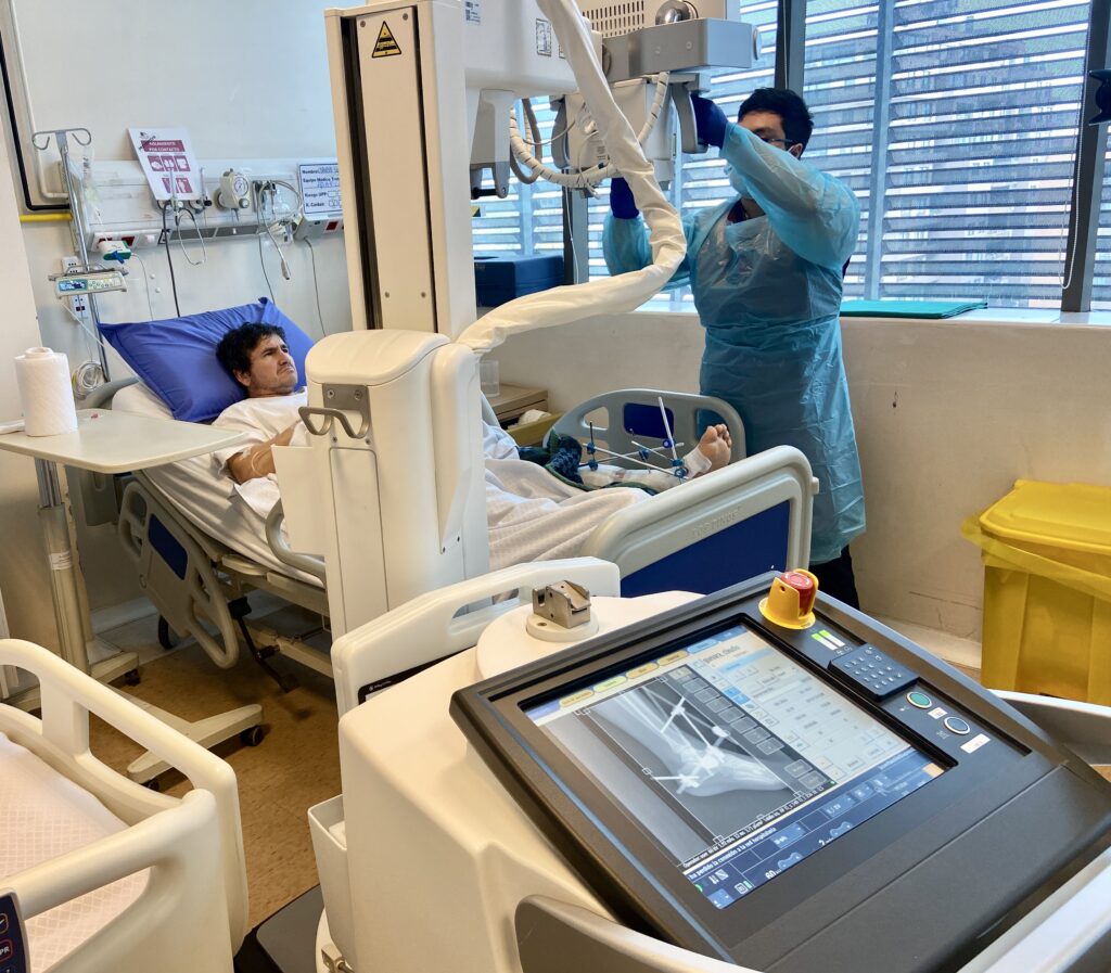 Hospital Traumatológico cuenta con nuevo y moderno equipo de rayos X ...